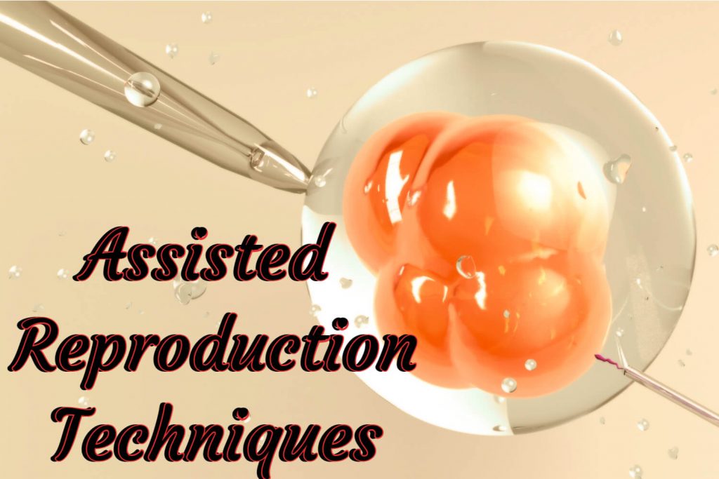 Basics Of IUI and IVF (Assisted Reproduction Techniques) - Being The Parent