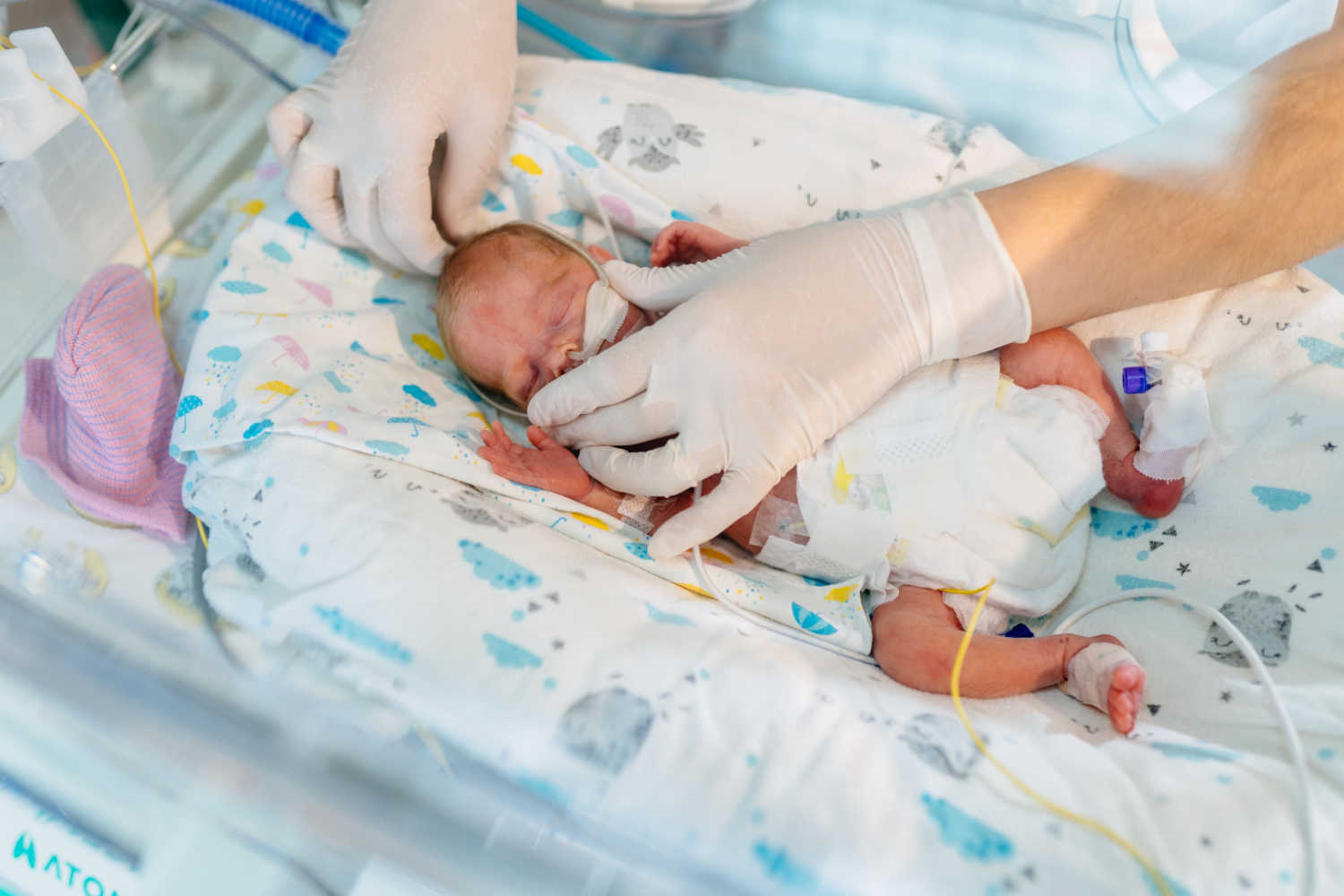 Dealing With the Death of a Premature Baby - Being The Parent