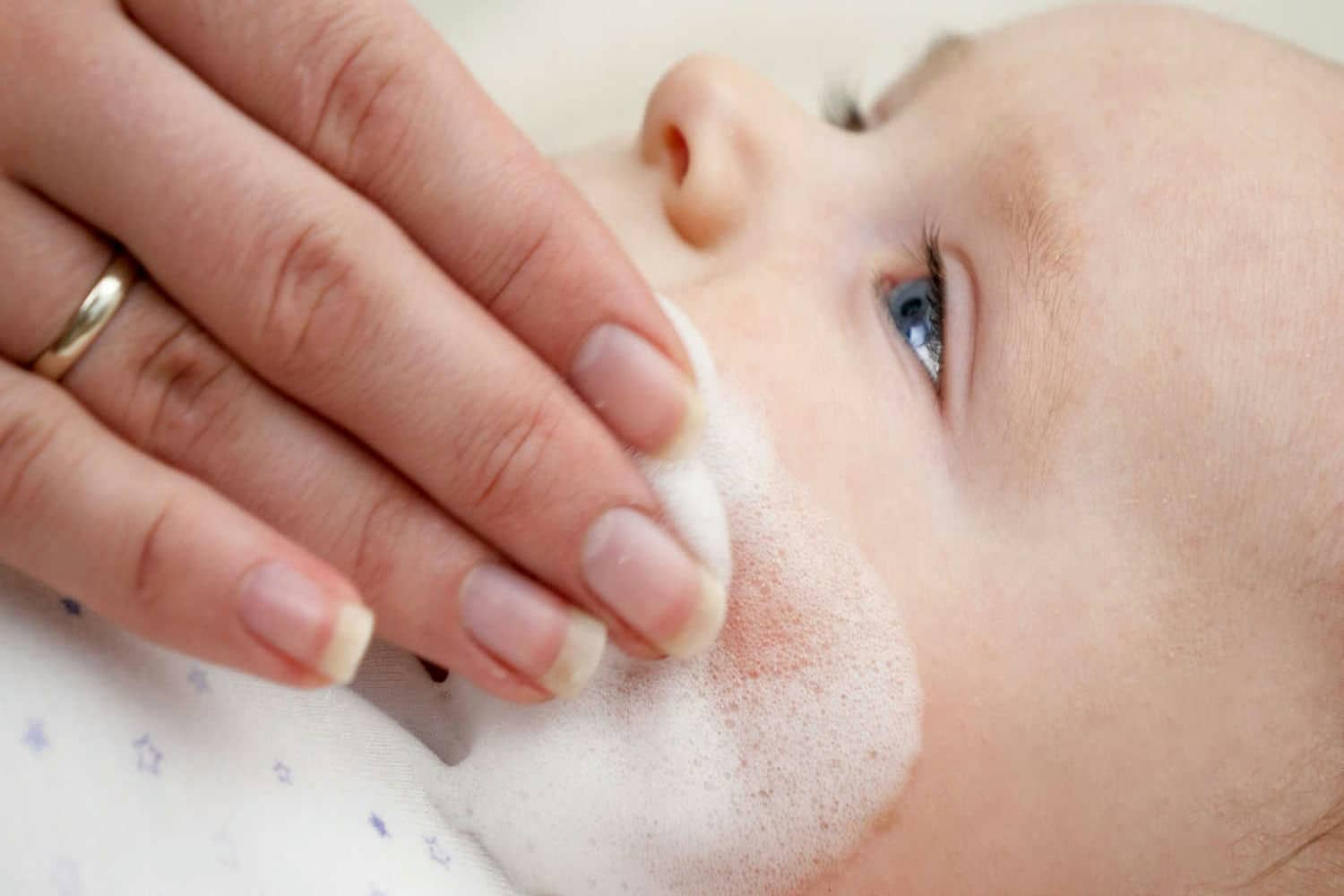 Baby Acne: What Causes Them And How You Can Prevent - Being The Parent