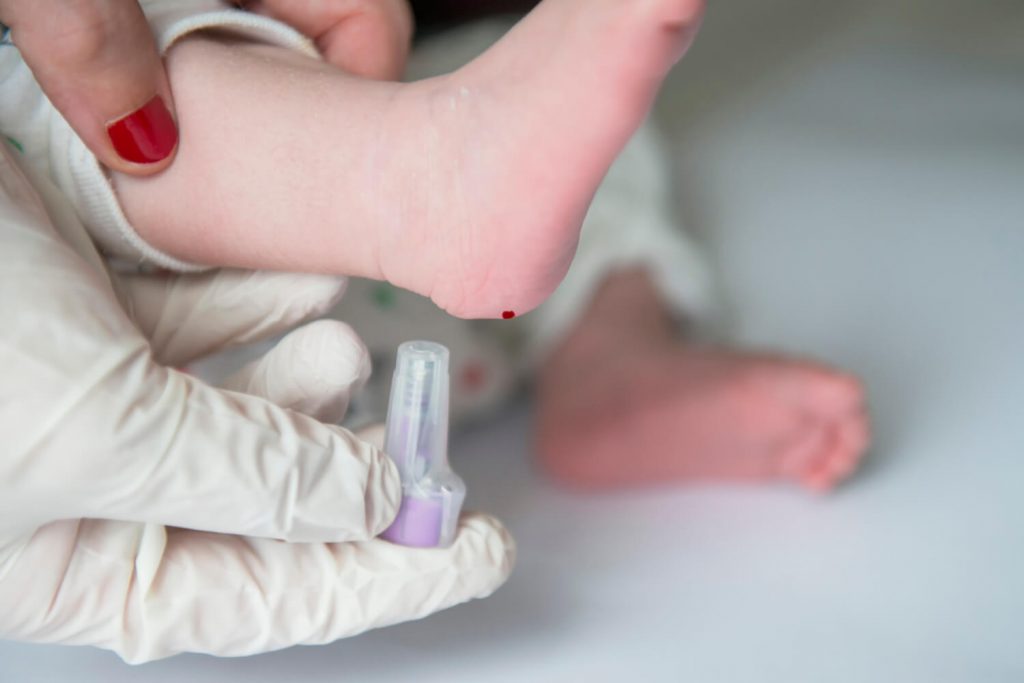 Neonatal Screening Tests in India - Being The Parent