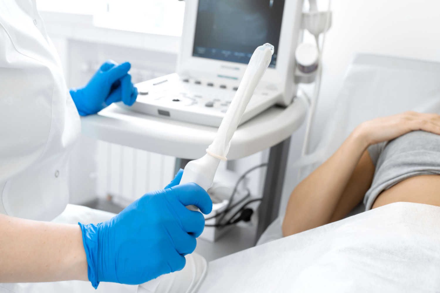 Transvaginal Scan During Early Pregnancy - A Complete Guide by Dr ...