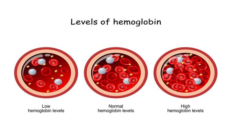 Maternal Hemoglobin Levels During Pregnancy - Being The Parent