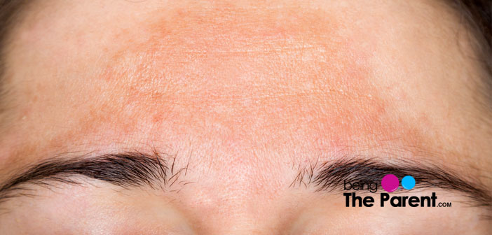 Skin Darkening During Pregnancy | Being The Parent