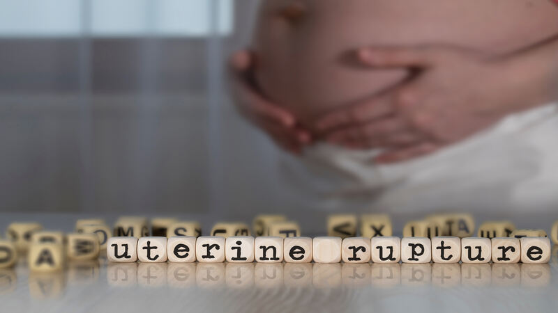 Uterine Rupture- Risk Factors, Complications, Causes And Treatment ...