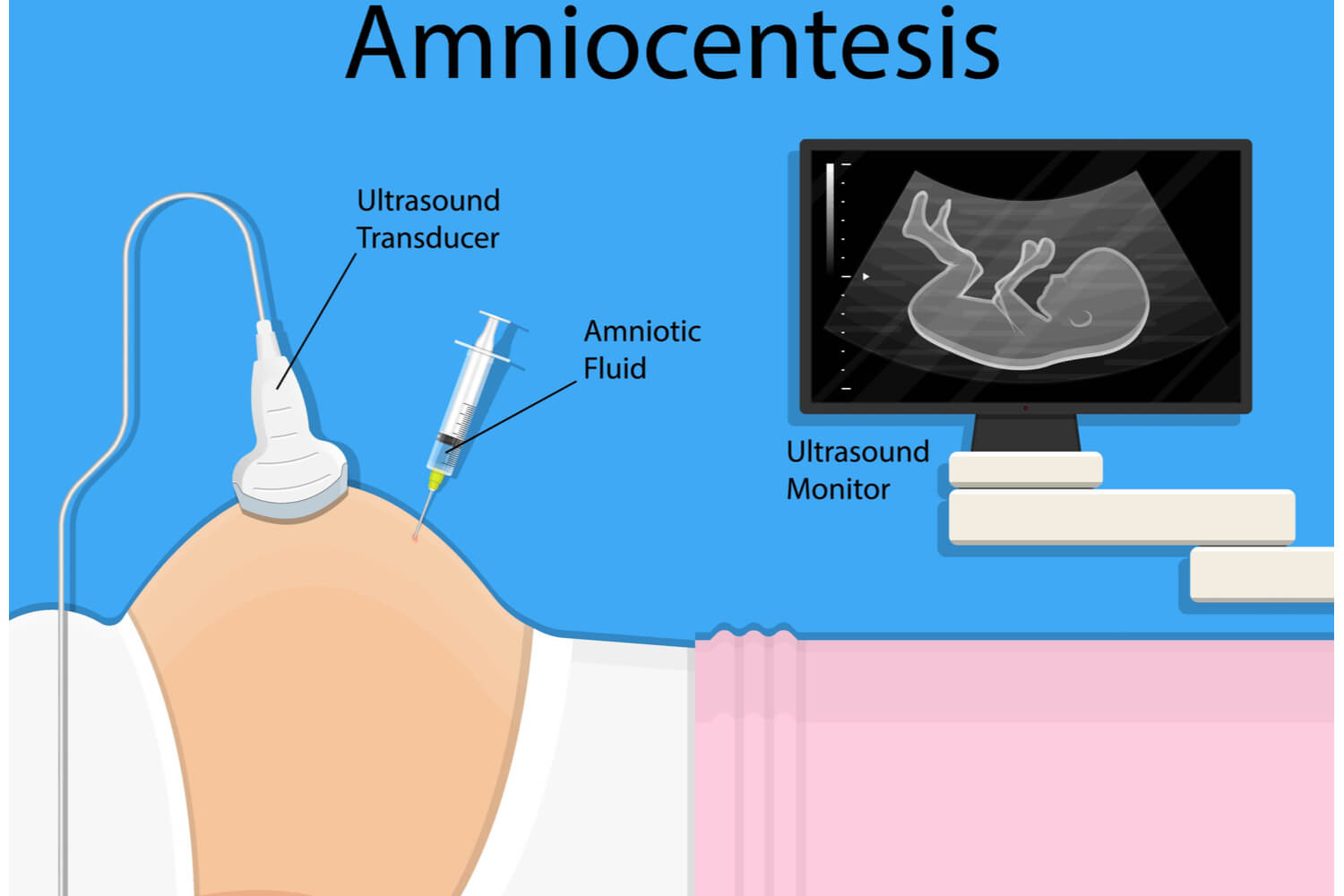 Fetal Anemia During Pregnancy - Being The Parent