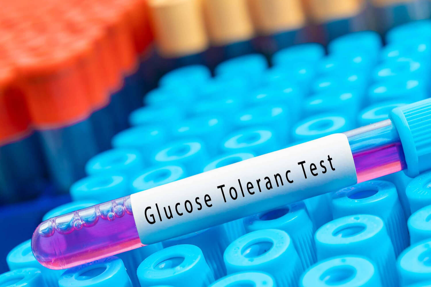 Glucose Screening Test And Glucose Tolerance Test During Pregnancy ...