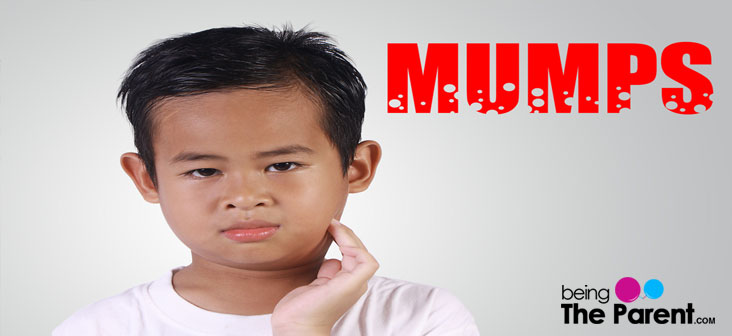 Mumps In Children – Causes, Symptoms And Treatment - Being The Parent