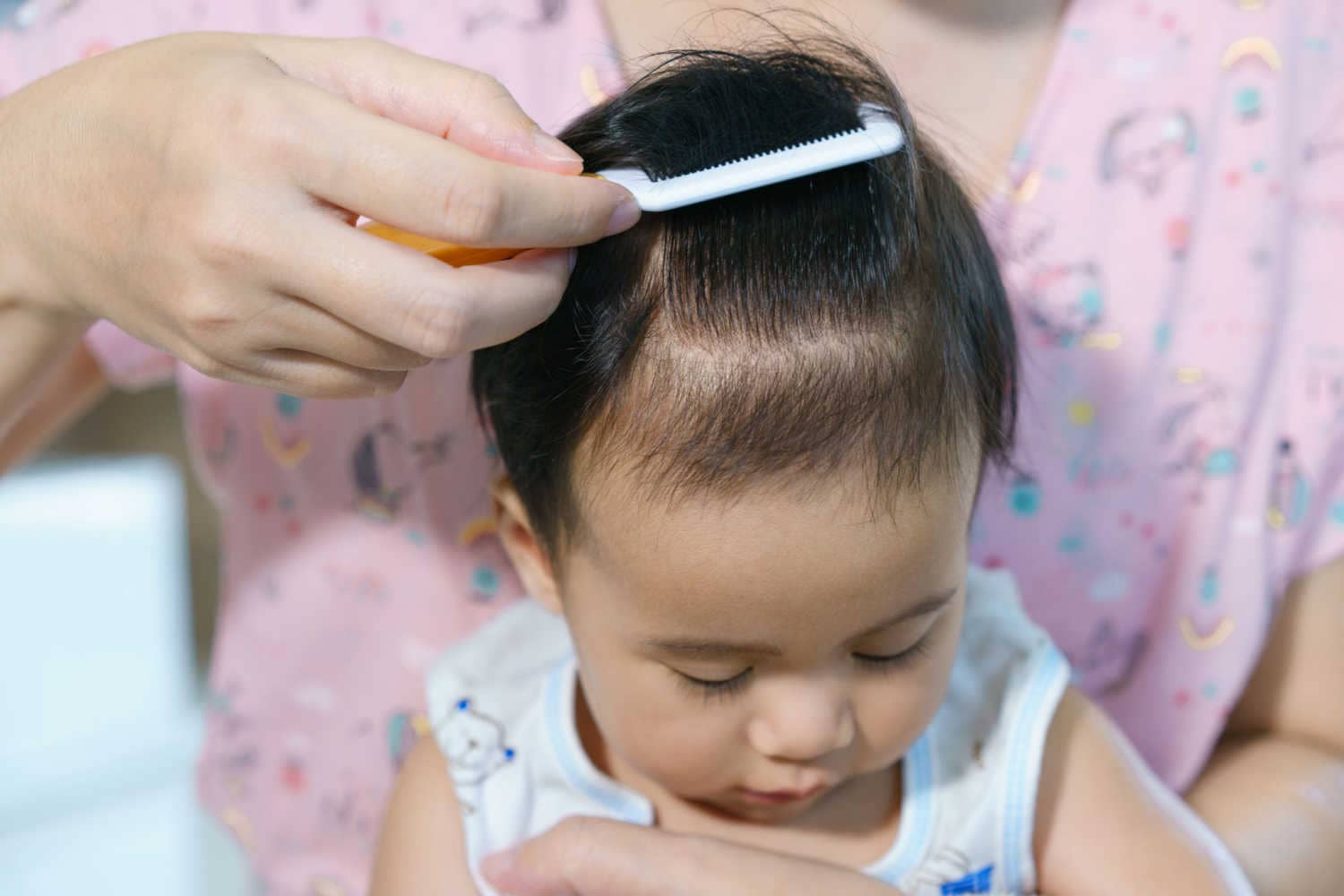 Dandruff In Babies – Causes, Symptoms and Treatment - Being The Parent