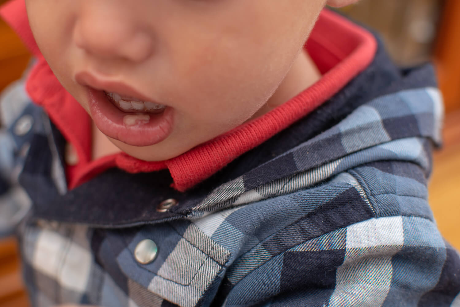 14 Home Remedies For Mouth Ulcers in Babies - Being The Parent