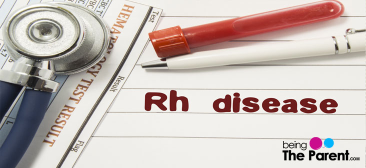 Causes, Symptoms, Diagnosis & Treatment For Rh Incompatibility - Being ...