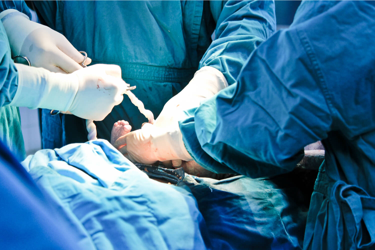 Emergency C-Sections – Reasons, Risks And Recovery - Being The Parent