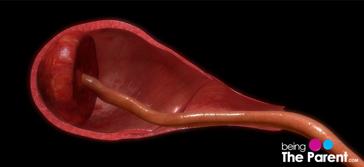 Retained Placenta: Causes, Symptoms And Treatment - Being The Parent