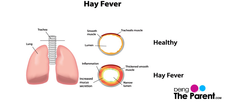 Hay Fever In Babies | Being The Parent