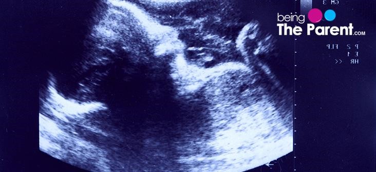 Third Trimester Growth Scan During Pregnancy - Being The Parent