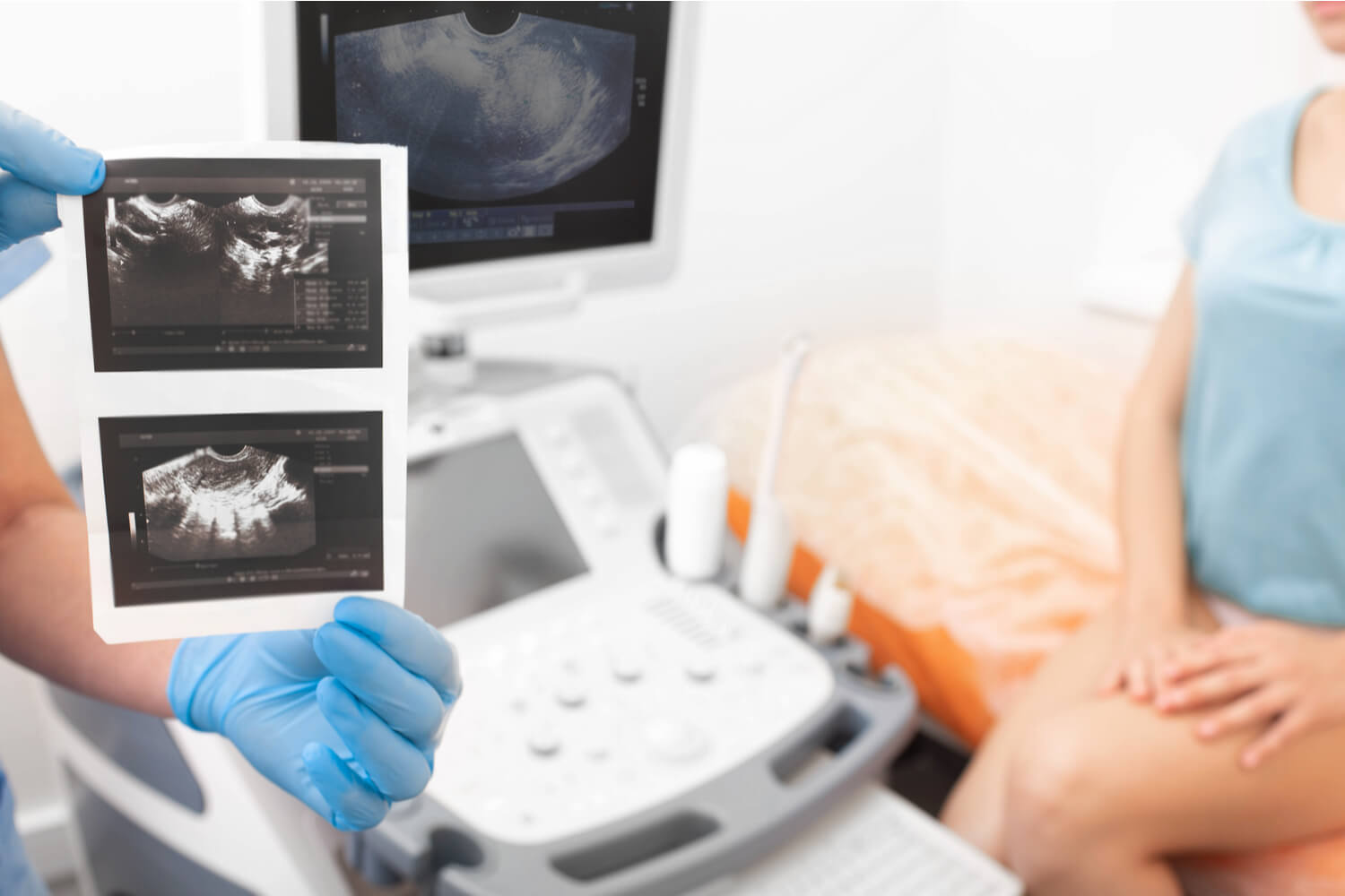 Ovulation Pain: Causes, Diagnosis and Treatment - Being The Parent