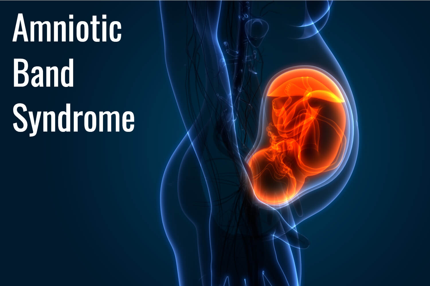 What Is Amniotic Band Syndrome And What Are Its Causes Being The Parent what-is-amniotic-band-syndrome-and-what-are-its-causes-being-the-parent