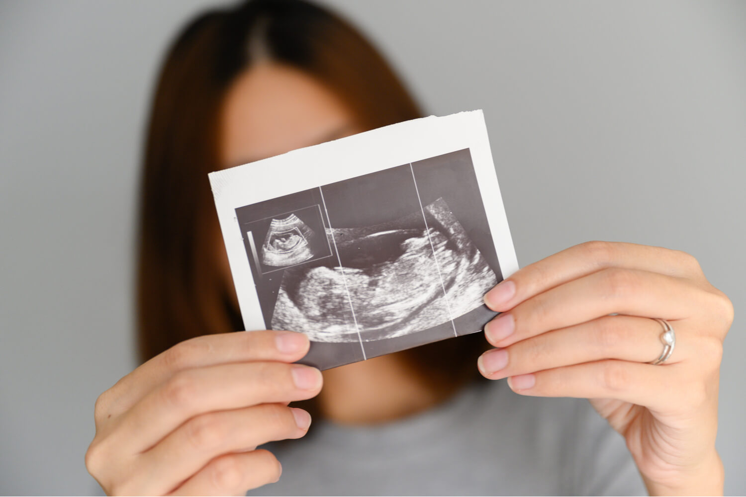 First Ultrasound During Pregnancy - Being The Parent