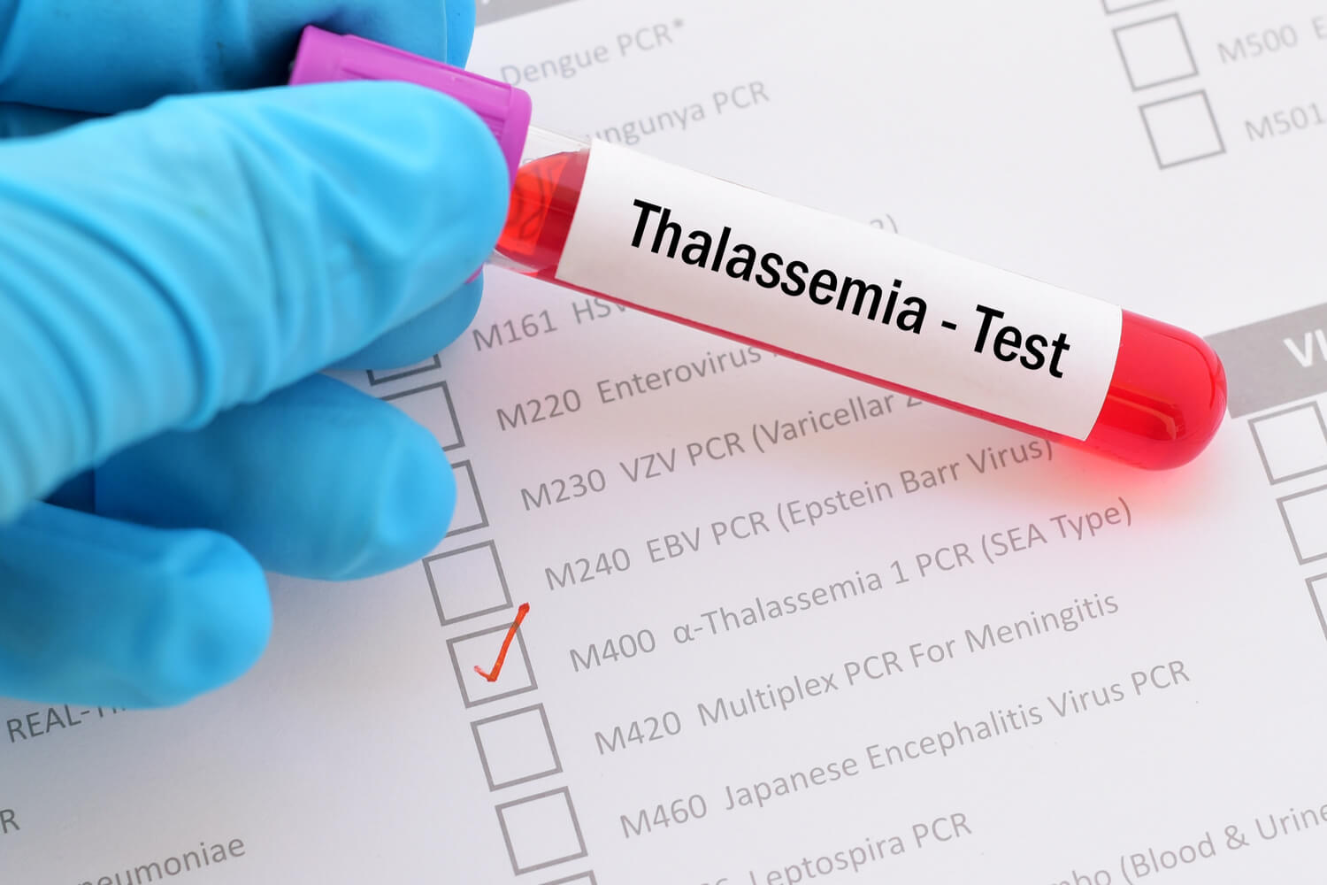 Thalassemia in Pregnancy - Symptoms and Treatment - Being The Parent