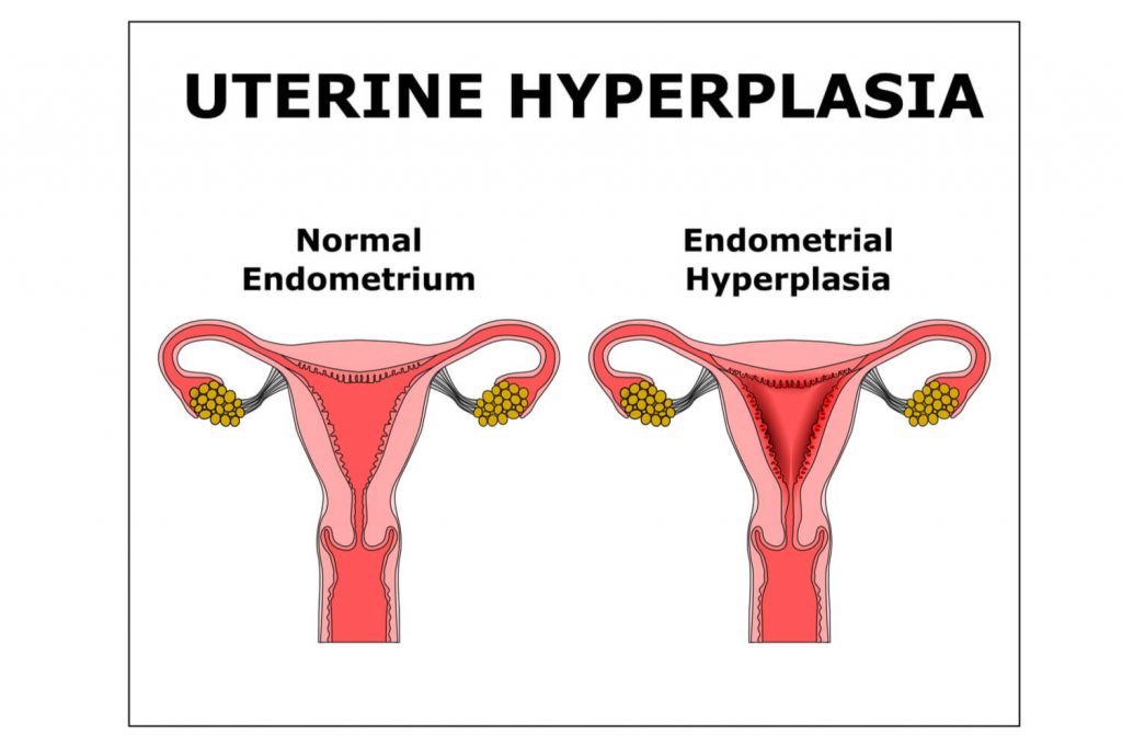 Normal Endometrium Thickness In Pregnancy - Being The Parent