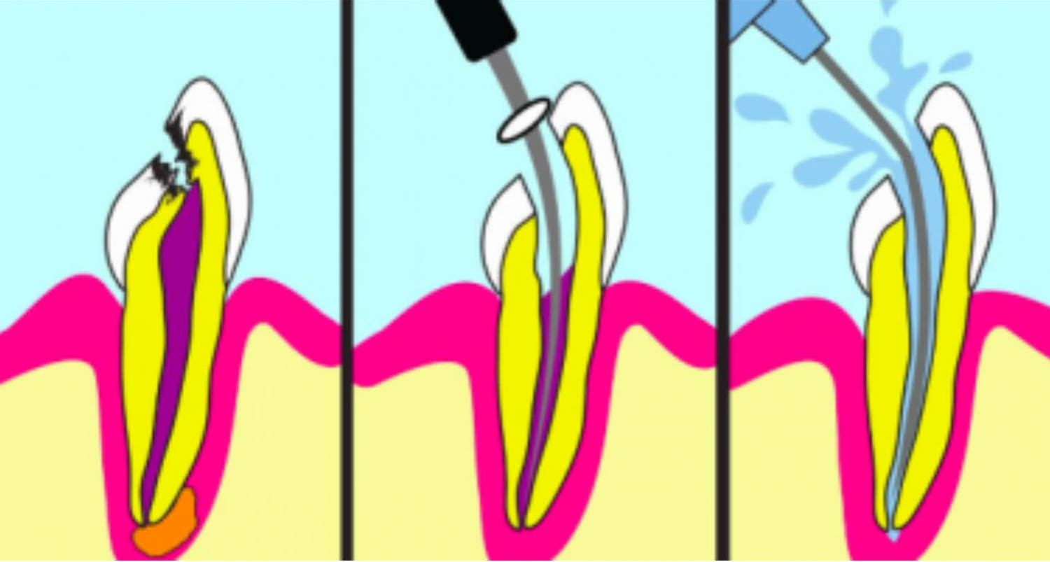 Common Procedures in Pediatric Dentistry - Being The Parent