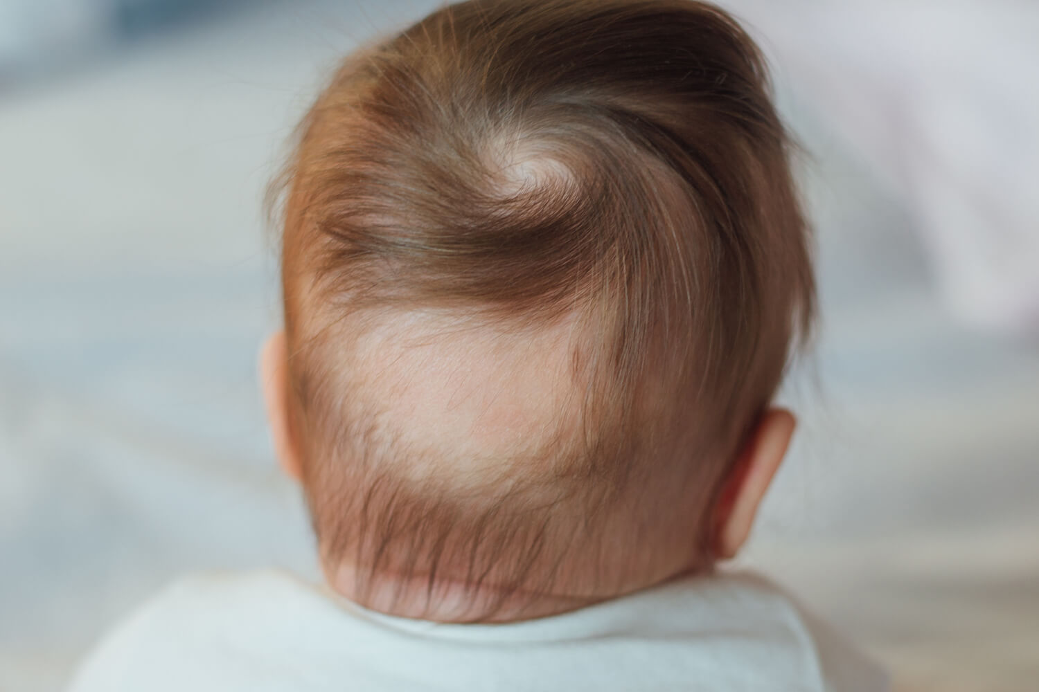 Alopecia Areata in Children: Causes & Treatment - Being The Parent