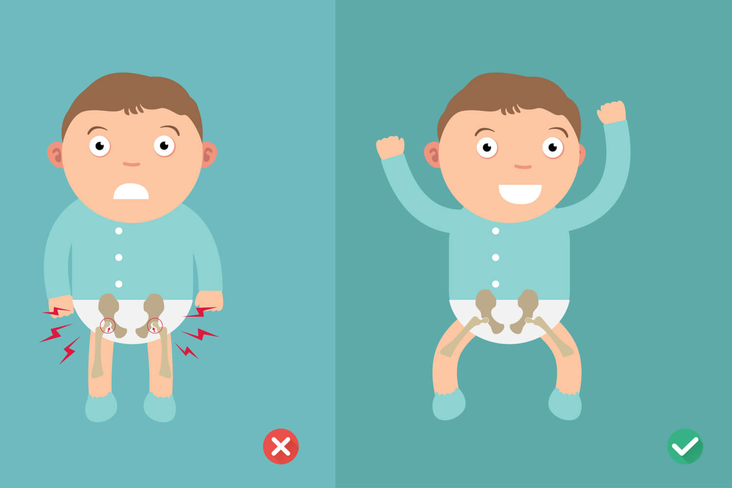 Clicky Hips in Babies - Being The Parent