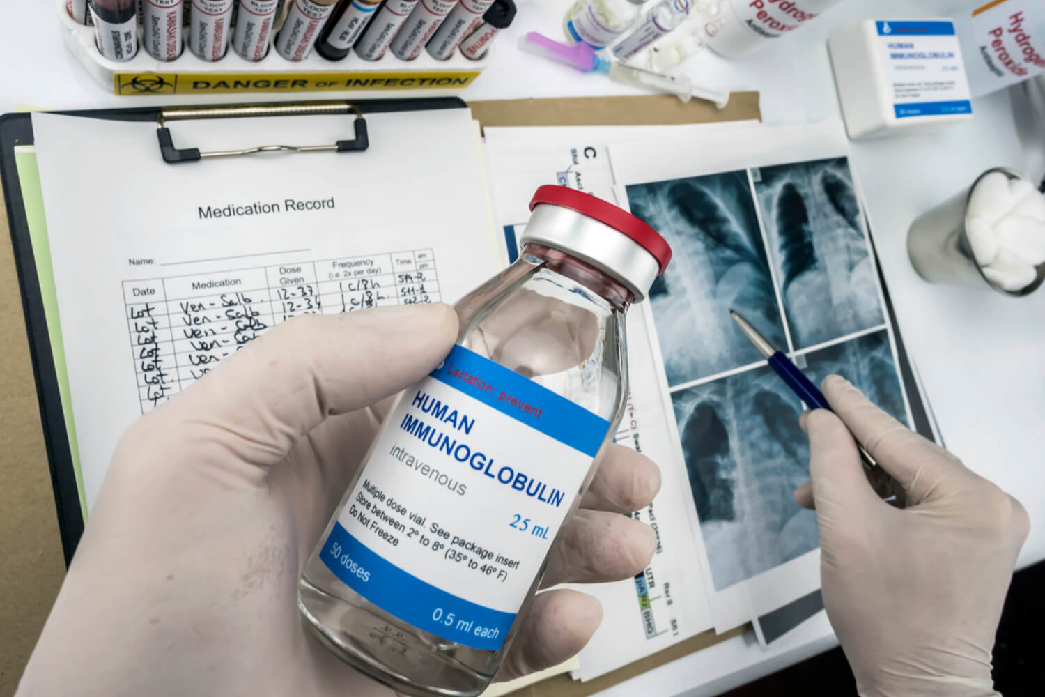 IV Immunoglobulin In Children Benefits For Low Immunity