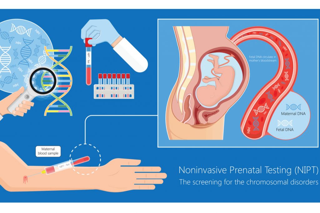 Non-Invasive Prenatal Testing (NIPT) And Why it is Crucial - Being The ...