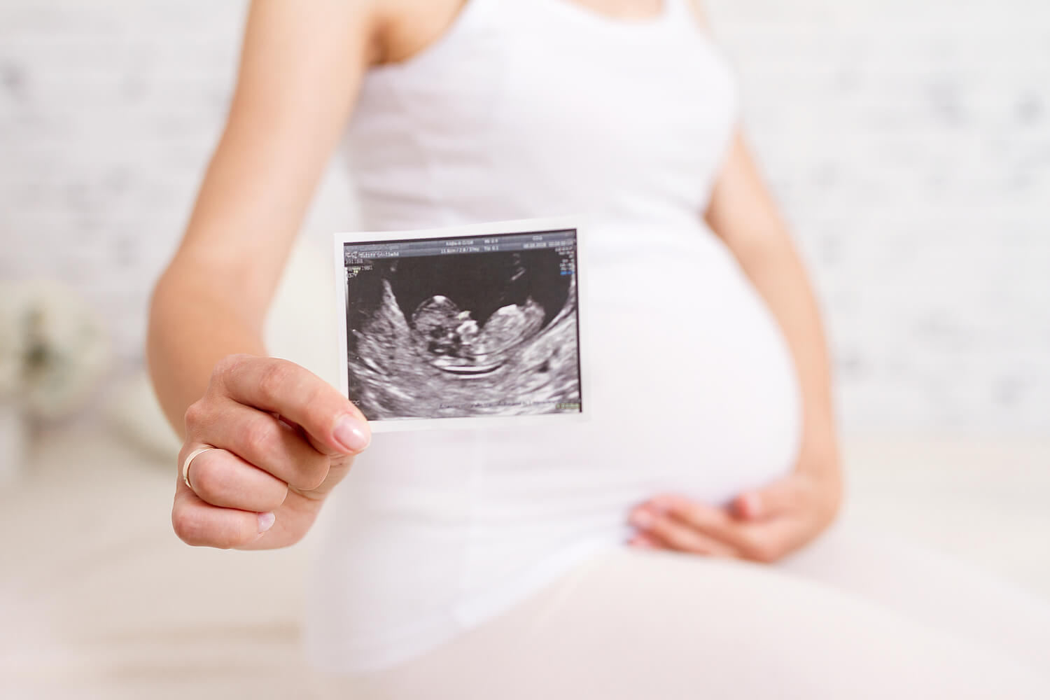 Know about Fetal Development of Baby's Bones