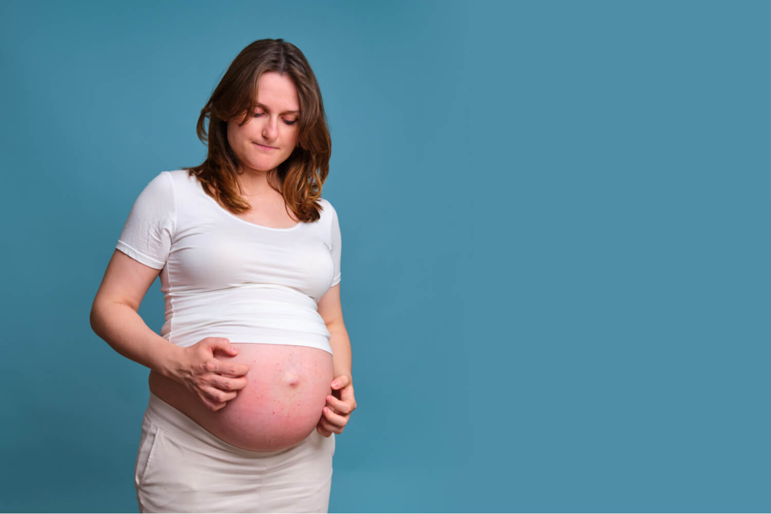 Puppp Rash During Pregnancy Causes Symptoms And Treatment Being The