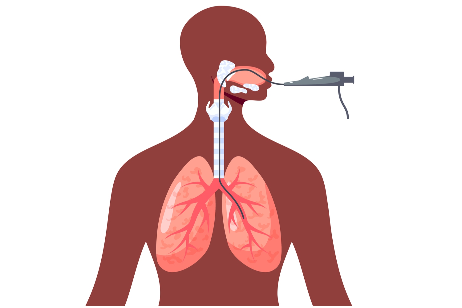 Bronchoscopy For Children – What To Expect by Dr. Srikanta J T - Being ...