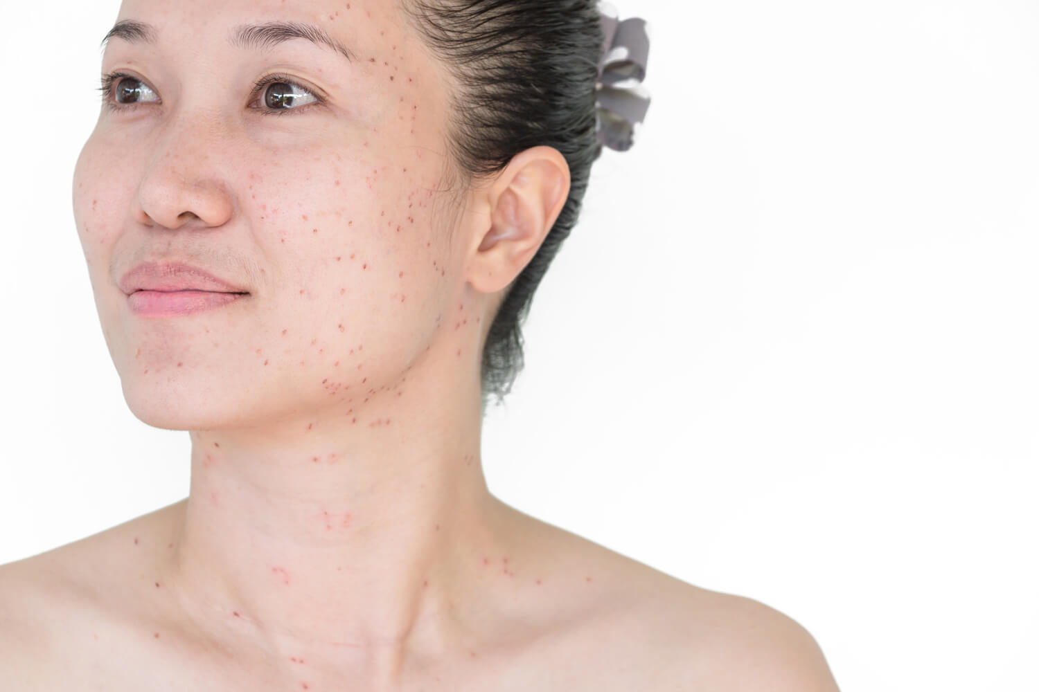 Skin Problems After Delivery - How to Take Care - Being The Parent