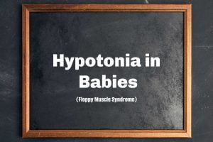 Hypotonia in Babies - Signs, Causes, Diagnosis and Treatment - Being ...