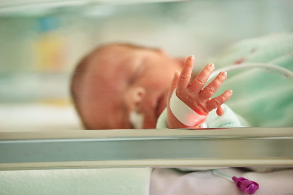 Polydactyly(Extra Fingers) in Babies - Causes, Symptoms And Treatment ...