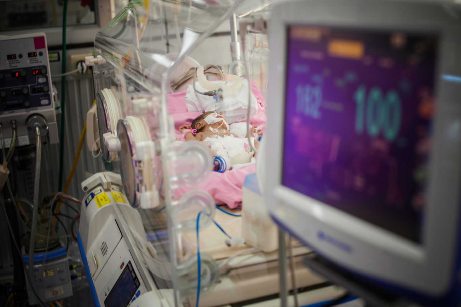 Transport of Critically ill Newborn - Everything You Need to Know by Dr ...