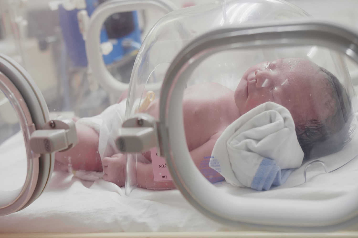 Transport of Critically ill Newborn - Everything You Need to Know by Dr ...