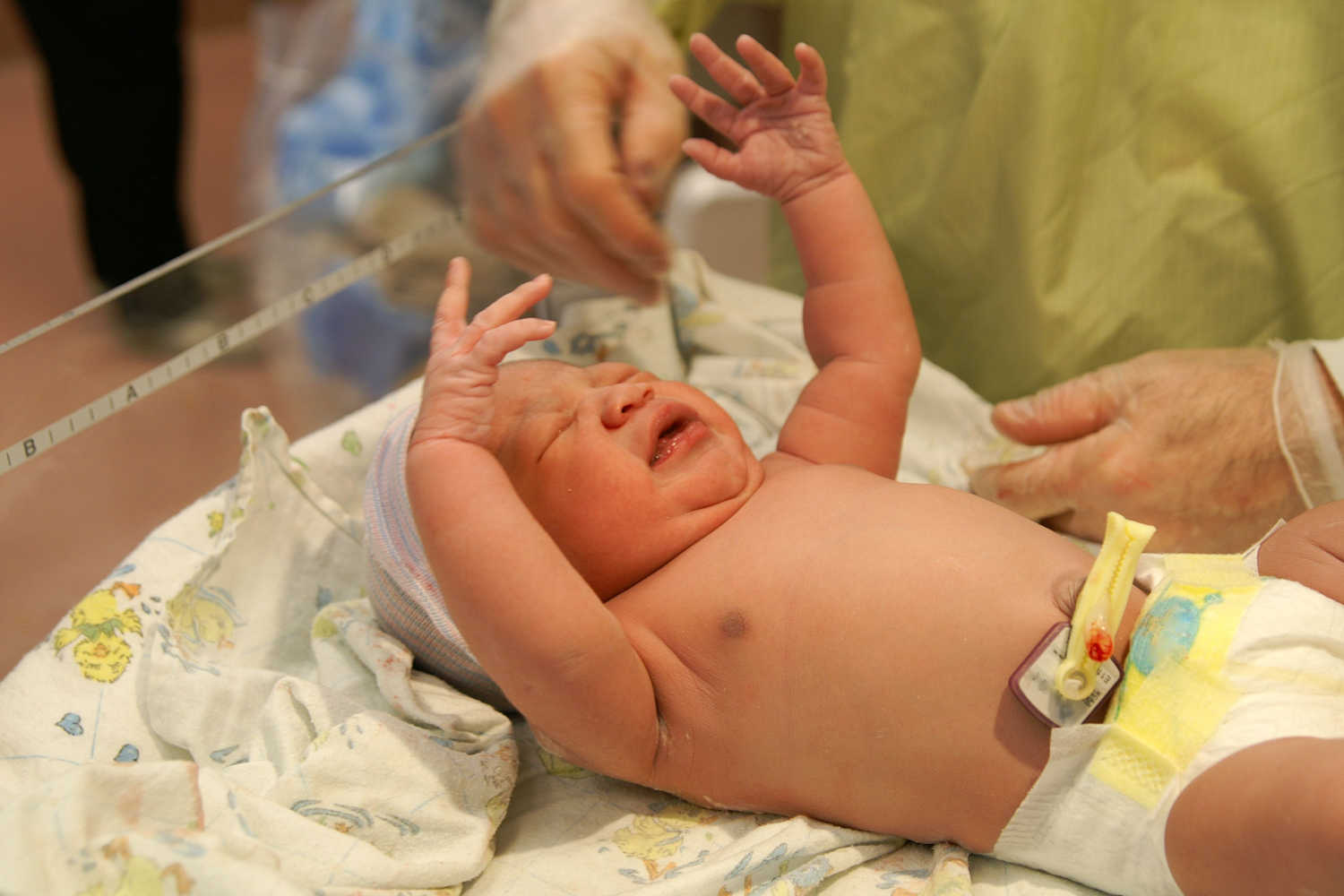 Omphalitis in Newborn Babies - Causes, Signs and Treatment - Being The ...