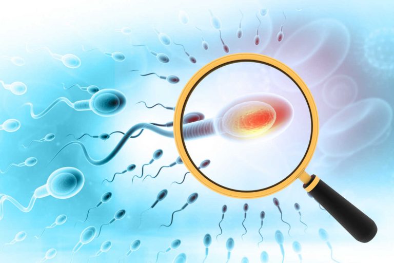 Diagnostic Tests For Male Infertility - When to Consider, Tips and List ...