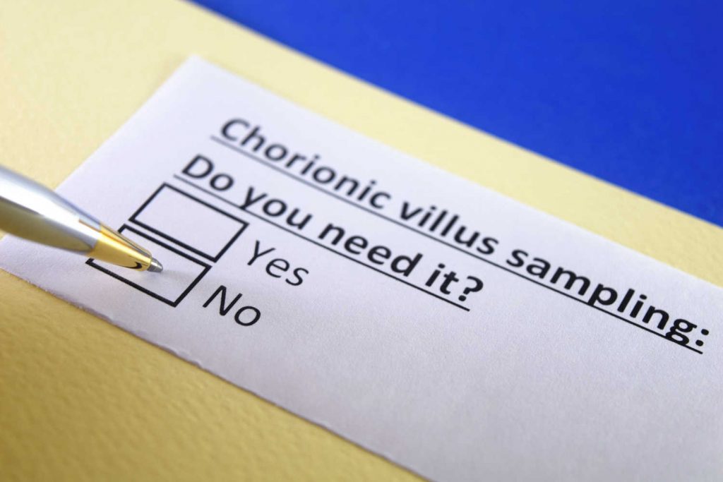 All About Chorionic Villus Sampling (CVS) - Being The Parent