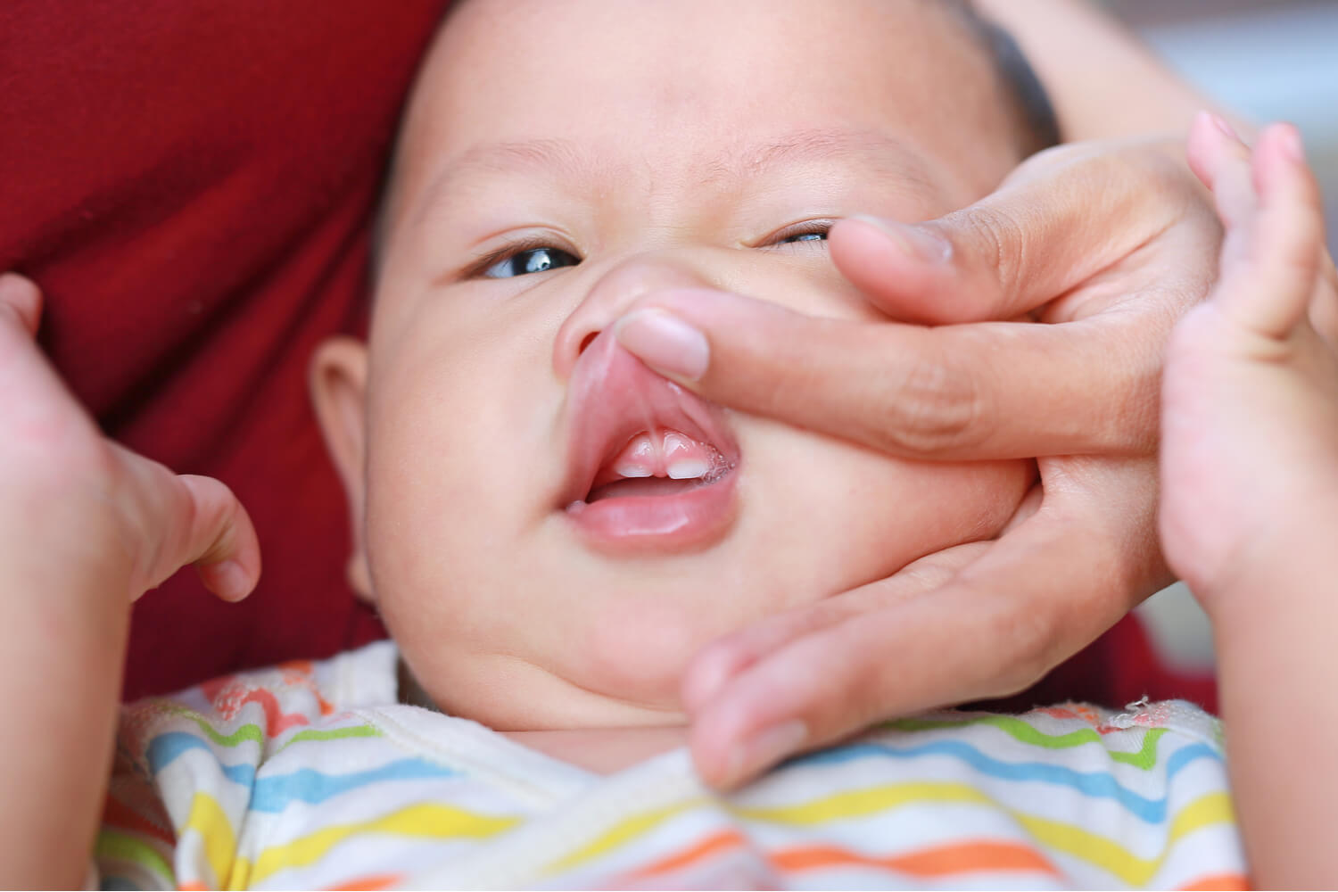 Lip Tie In Babies Causes Signs And Treatment Being The Parent