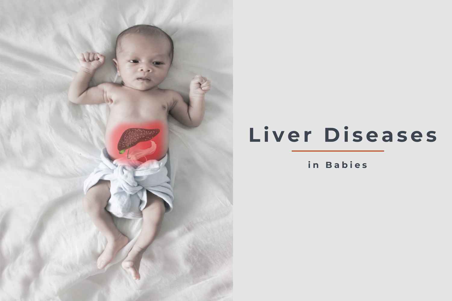 Liver Diseases in Babies - Causes, Symptoms, Diagnosing and Treatment