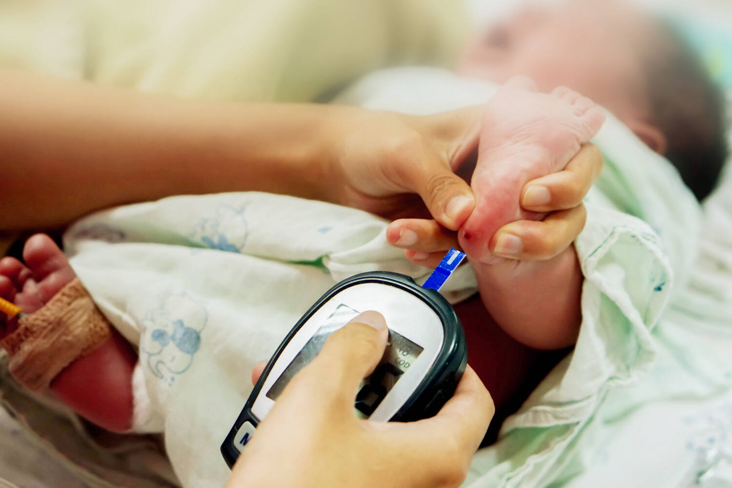 Neonatal Hypoglycemia - Causes, Symptoms & Prevention