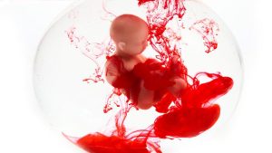 D and C Surgery Procedure, Side Effects and Recovery - Being The Parent