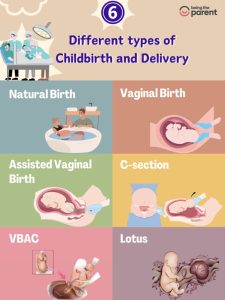 6 Different Types of Delivery Methods You Must Know - Being The Parent