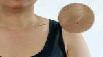 Home Remedies for Common Pregnancy Discomforts