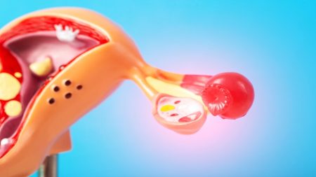 Fallopian Tube Cysts During Pregnancy - Being The Parent