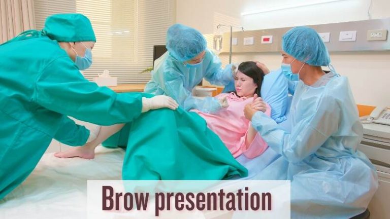 What Is Brow Presentation? Causes and Complications - Being The Parent